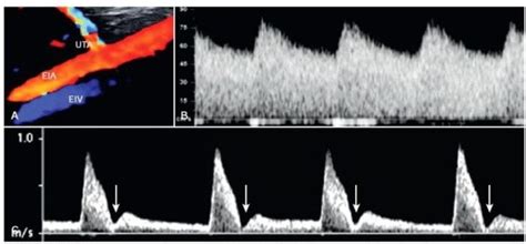 Manual De Doppler Radiologia Online