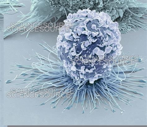 Activated Macrophage Under A Microsco Stock Image Science Source