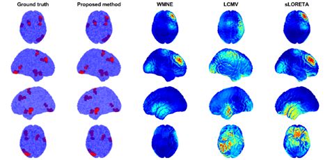 Comparisons With Source Reconstruction Methods Wmne Lcmv Sloreta
