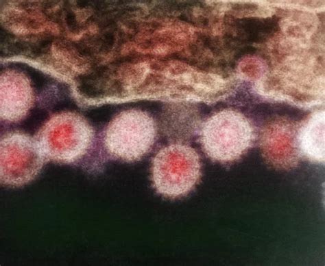 Deadly Eye Bleeding Virus Found In France Could Make Its Way To Uk