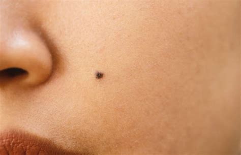What Your Skin Says About Your Health