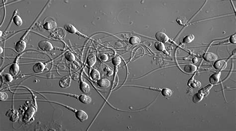 Sperm Cell Under Microscope