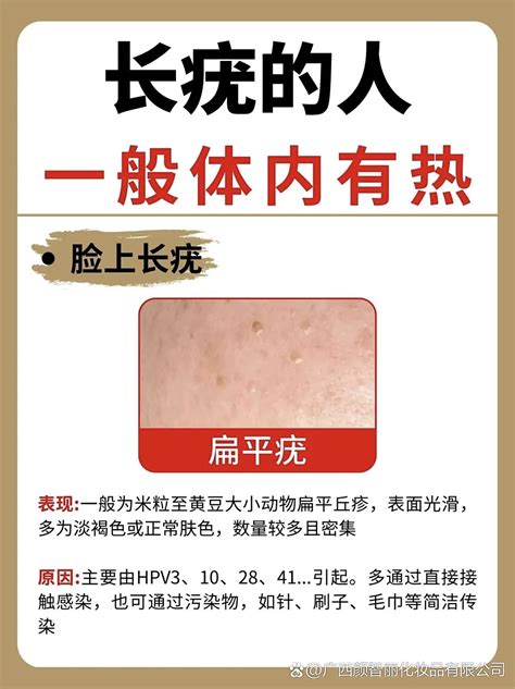 认识疣体疣体是由人乳头瘤病毒（hpv）感染引起的皮肤良性增生。
