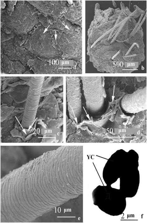 Scalp Psoriasis And Biofilms Electron Microscopy Medcrave Online Scalp Psoriasis And Biofilms Electron Microscopy Medcrave Online
