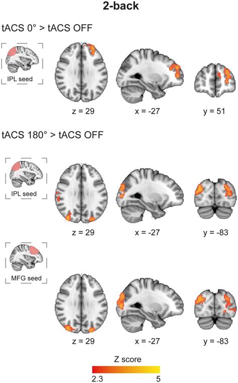 Figures And Data In Externally Induced Frontoparietal Synchronization Modulates Network Dynamics