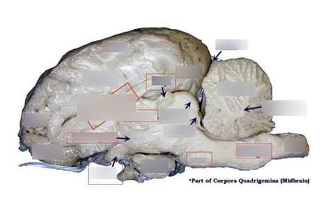 Lab Practical Quiz 5 Sheep Brain Diagram Diagram Quizlet