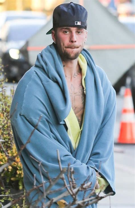 Shock Pics Show Justin Biebers Decline Gold Coast Bulletin