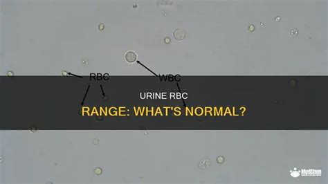 Urine Rbc Range Whats Normal Medshun