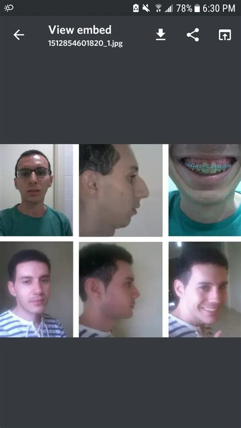 Looksmaxxing Before And After What To Expect For Looksmaxxing