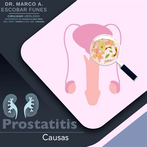 Causas La Prostatitis Bacteriana Aguda Es Provocada Generalmente Por