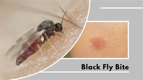 20 Insects That Bite And Sting Identify The Diferences