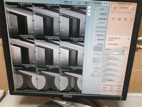 rahul kumar on linkedin what is this problem