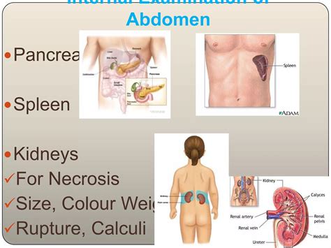Post Mortem Examinationautopsy Pptx