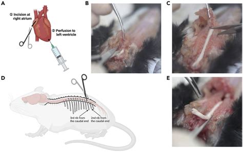 Dissection Of Mouse Spinal Cord A A Schematic Illustration Of