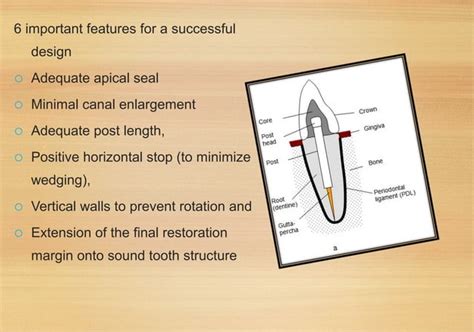 Restoration Of Endodontically Treated Teeth Ppt