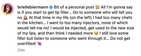 Brielle Biermann Warns Against Getting Lips ‘overfilled With Shocking Before And After Photos