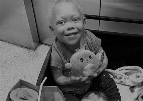 Nie żyje Bella Thomson Przez Chorobę Wyglądała Jak Niemowlę