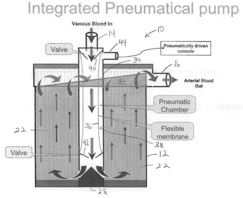 Perfusion Pump Patented Technology Retrieval Search Results Eureka
