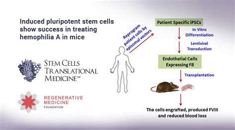 Induced Pluripotent Stem Cells Show Success In Treating Hemophilia A In