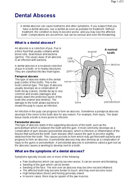Dentalabscesspdf Human Tooth Dentistry Free 30 Day Trial Scribd