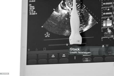 Perangkat Ultrasonik Modern Dengan Sensor Ultrasonik Gambar Hitam Dan