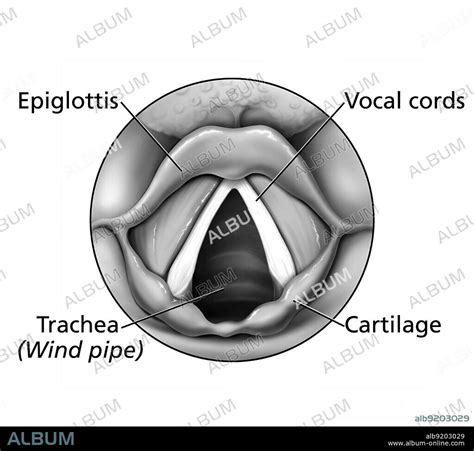 Epiglottis Diagram