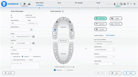 How To Import Or Update Scan Body Libraries Into Elite Database