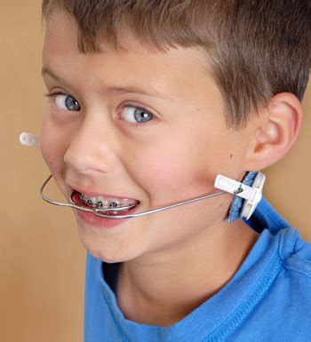 Orthodontic Headgear Weisner Orthodontics Methuen Ma