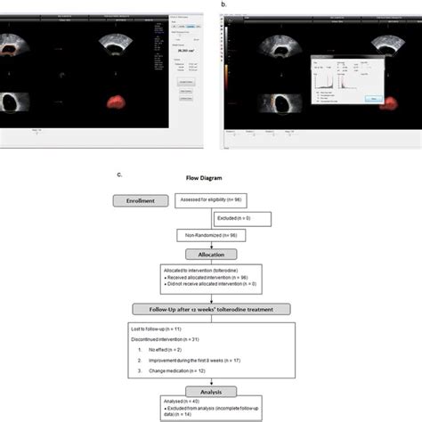 A Bladder Wall Volume B Bladder Wall Power Doppler Flow Indices Download Scientific