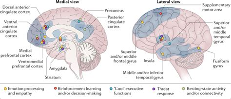 Superior Temporal Gyrus