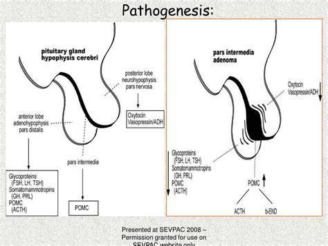 Ppt Pituitary Pars Intermedia Dysfunction Ppid Powerpoint