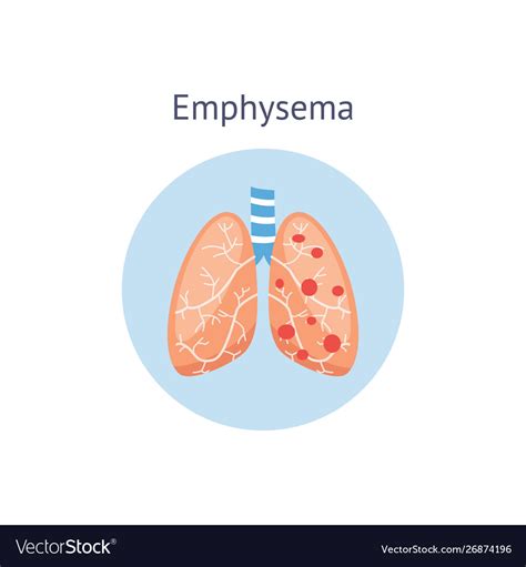 Emphysema Disease