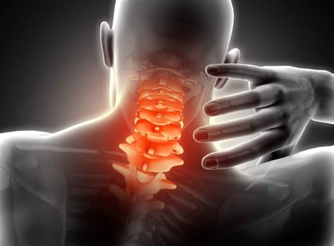 Exercises To Fix Your Nerd Neck And Desk Slouch Fitness Volt