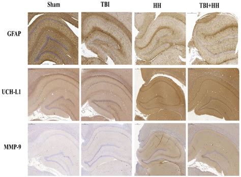 Hippocampus Staining For Gfap Uch L1 And Mmp 9 In Each Group We Can