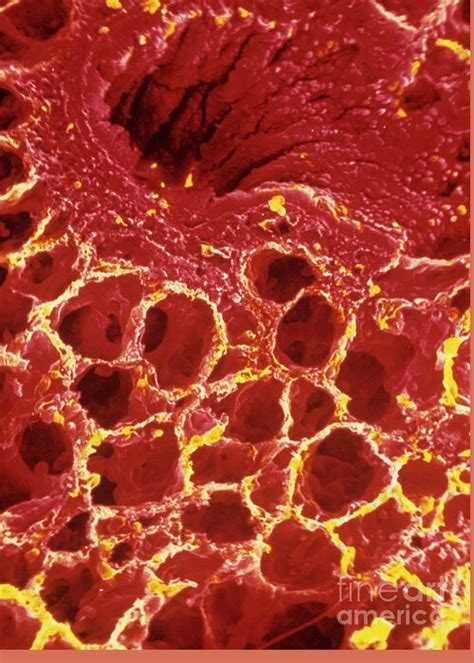 False Colour Sem Of A Section Of Human Lung Tissue 3 Greeting Card By