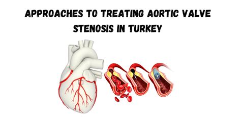 Approaches To Treating Aortic Valve Stenosis In Turkey Get Fast