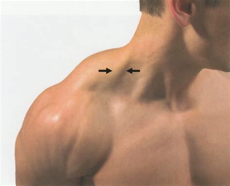 Shoulder Lymph Nodes