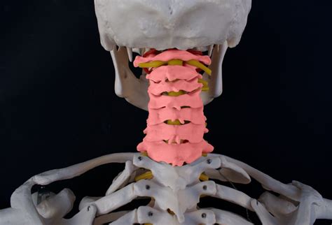Cervical Posterior Foraminotomy In New Jersey New York Spine Specialist