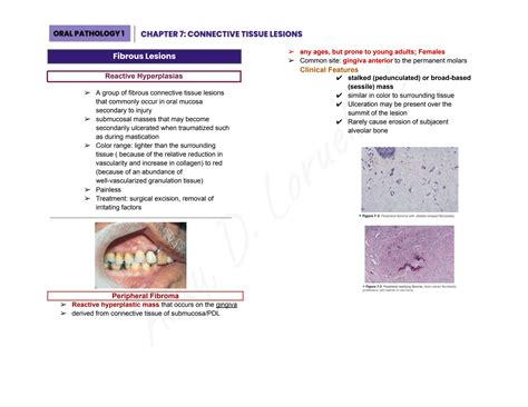 Solution Oral Pathology Connective Tissue Lesions Studypool
