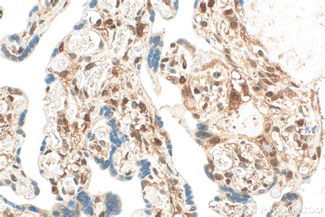 Ppar Gamma Antibody 81490 5 Rr Proteintech