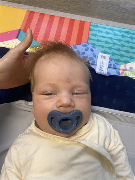 Brachycephaly Scaphocephaly Plagiocephaly Oh My — Year One Wellness Pediatric Physical And