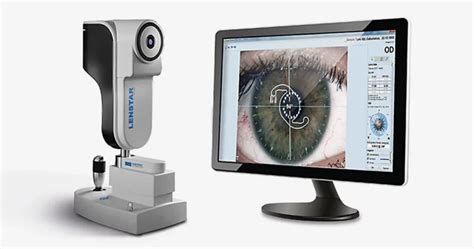 Artificial Intelligence Cataract Surgery Benefits And Cost Analysis