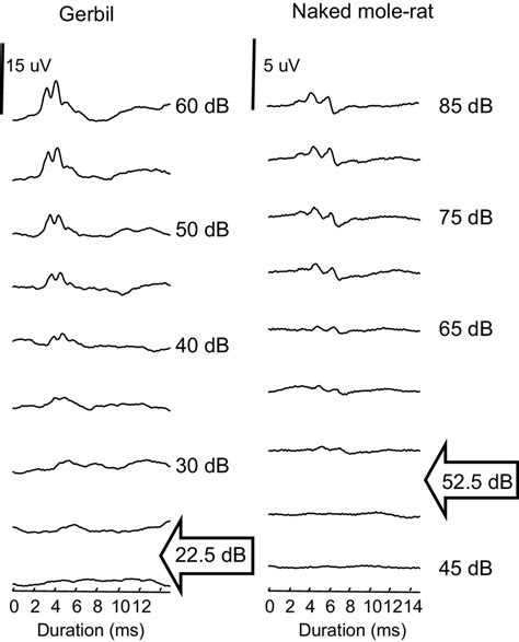 Abr Waveforms Evoked By A 2 Khz Tone Train Presented At Different