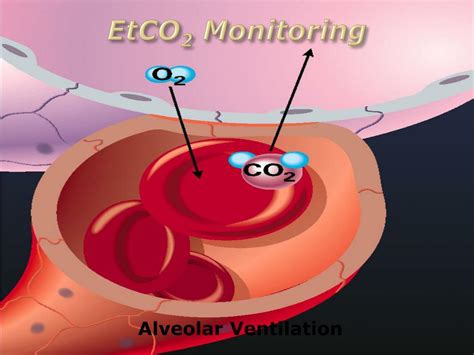 Ppt End Tidal Co 2 Etco 2 Monitoring Powerpoint Presentation Free