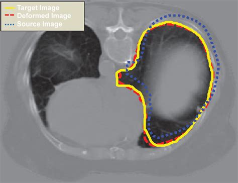 results of application of the proposed inverse mapping algorithm in