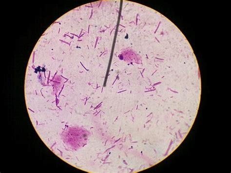 Parasitology Lab Exam 1 Flashcards Quizlet