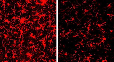 David Holtzman Md Brain Immunology And Glia Washington University In