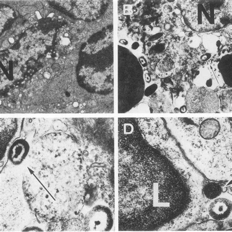 Histological Observations Of A Normal Peyers Patch And The Peyers