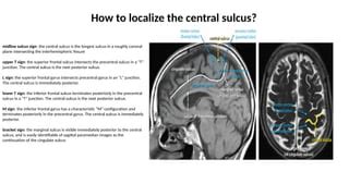 Anatomy Of Brain Ct And Mri Of Brainpptx
