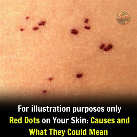11 Reasons Why You Have Red Dots On Your Skin